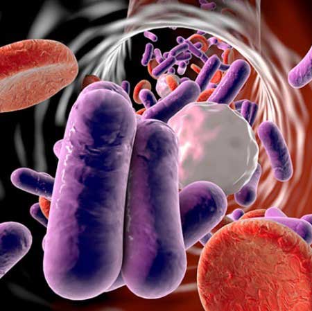 Understanding Sepsis | Portsmouth Hospital