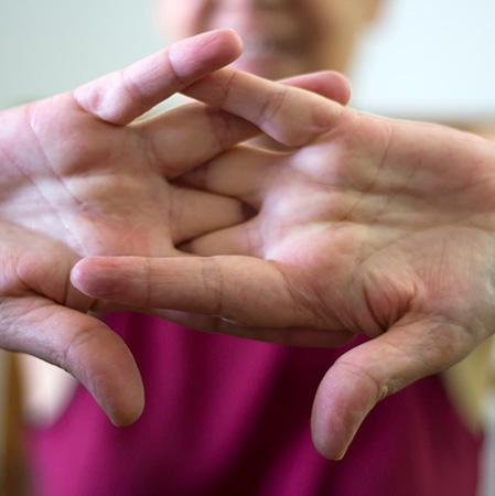 Does cracking knuckles cause arthritis? | Portsmouth Hospital
